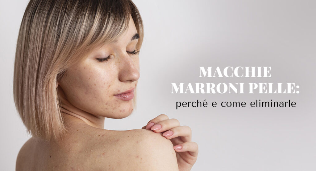 Macchie scure sulla pelle: perché succede e come eliminarle